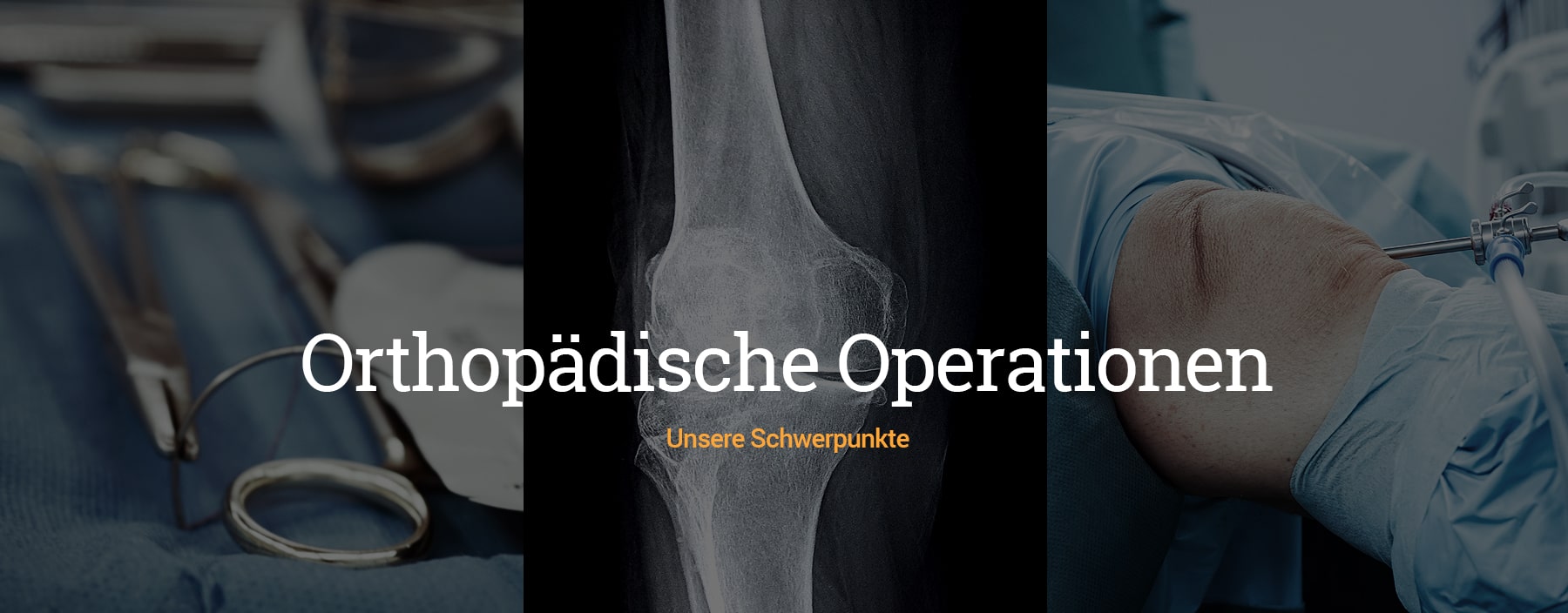 Orthopädische Operationen – Orthozentrum Aggertal